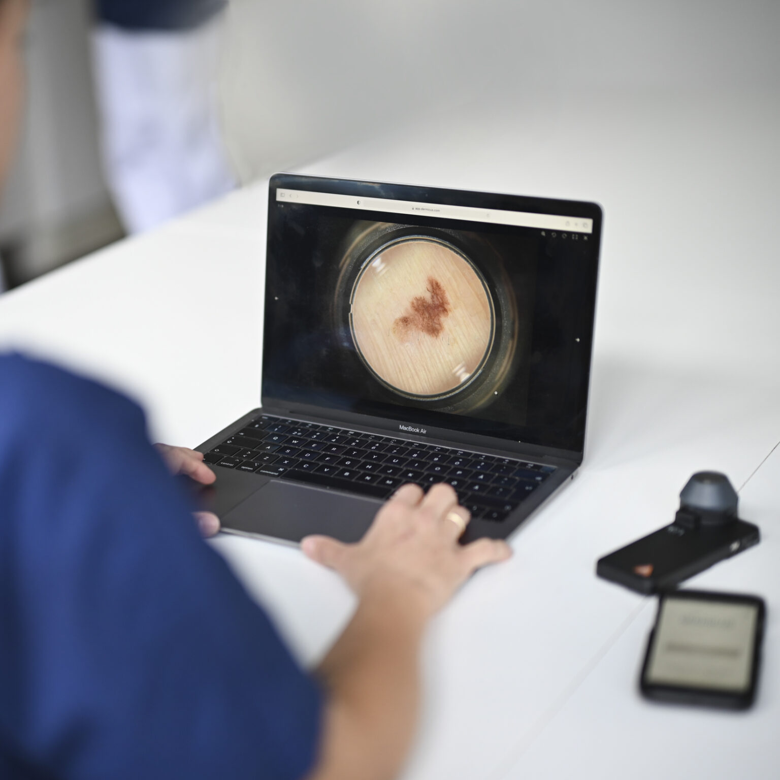 For fast and secure diagnosis of skin cancer and wound management ...